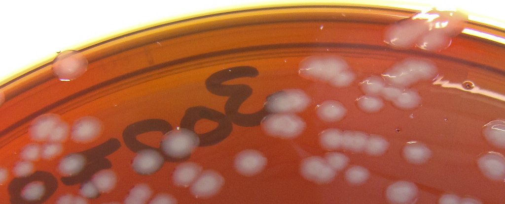 Gonoreea ar putea deveni rezistenta la toate antibioticele | Sound of ...